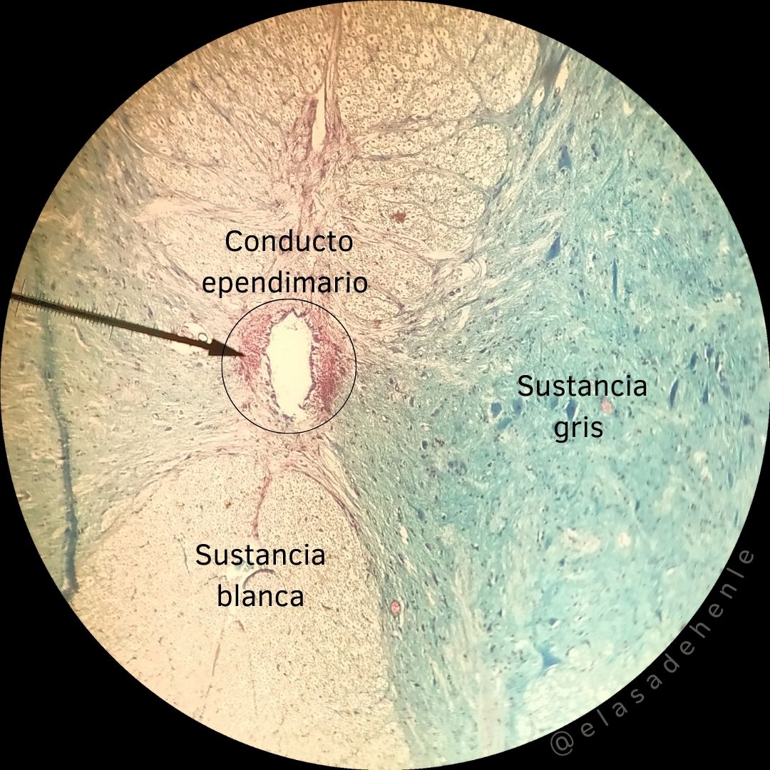 ¿Qué estructuras identificar en un preparado histológico de médula ...