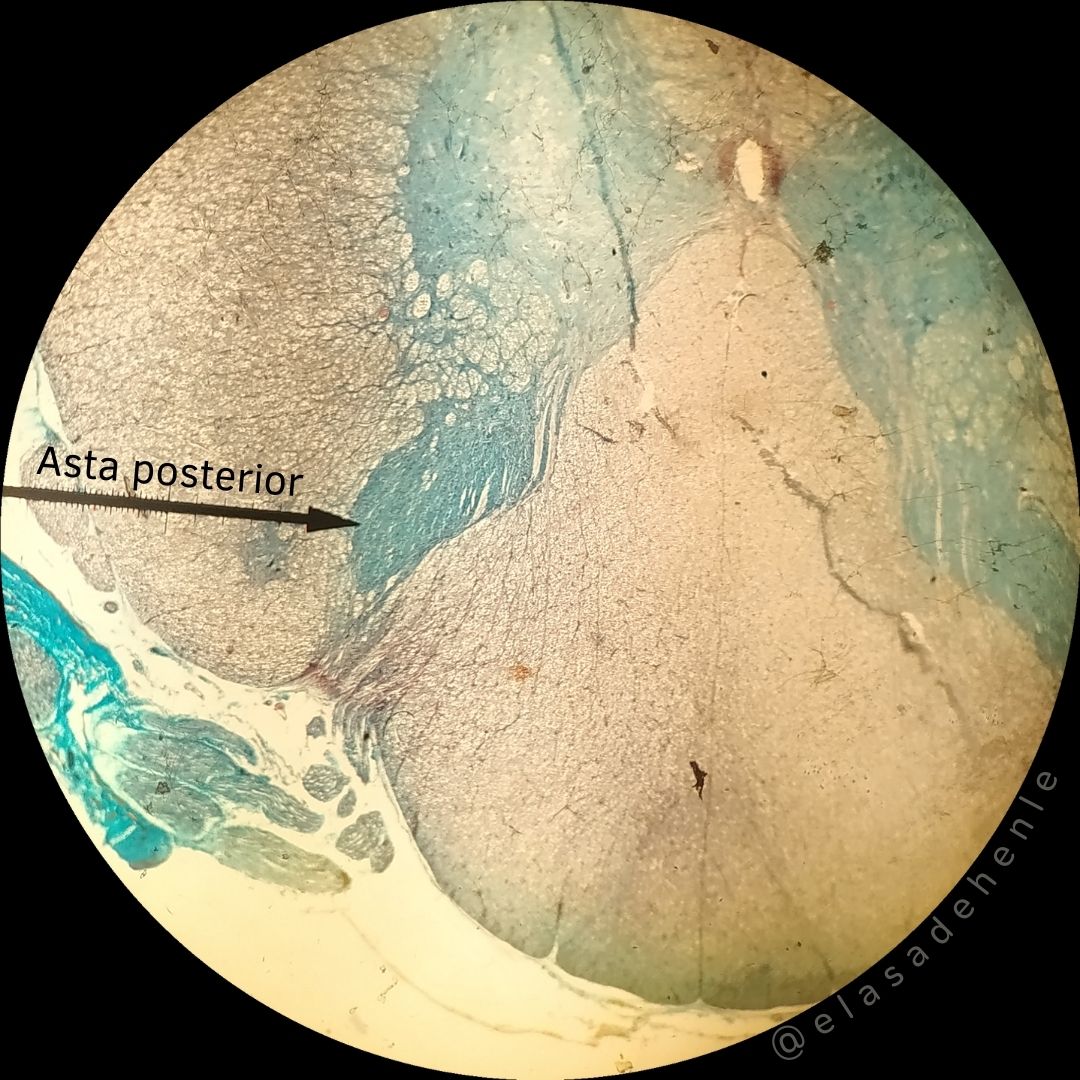 ¿Qué estructuras identificar en un preparado histológico de médula ...