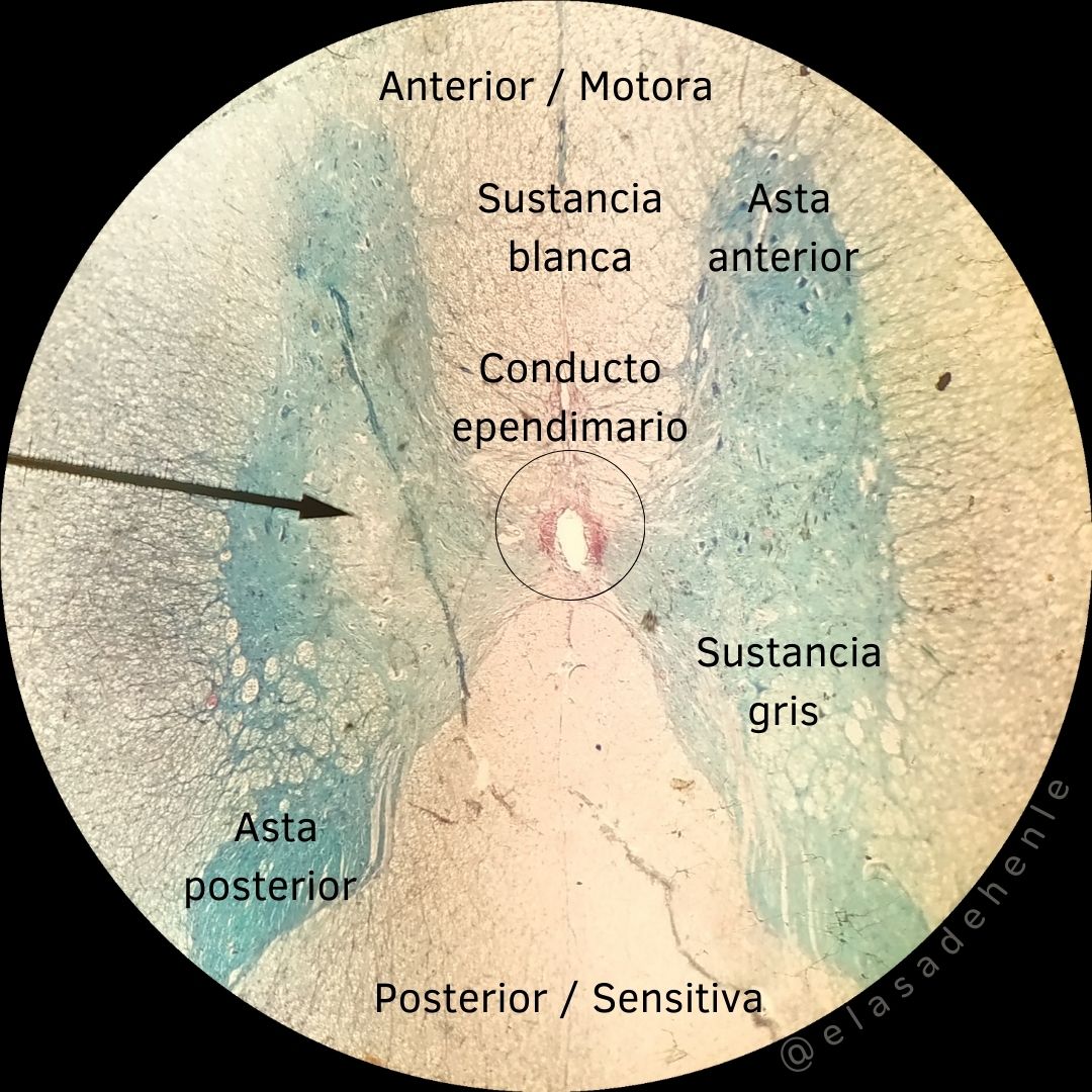 ¿Qué estructuras identificar en un preparado histológico de médula ...