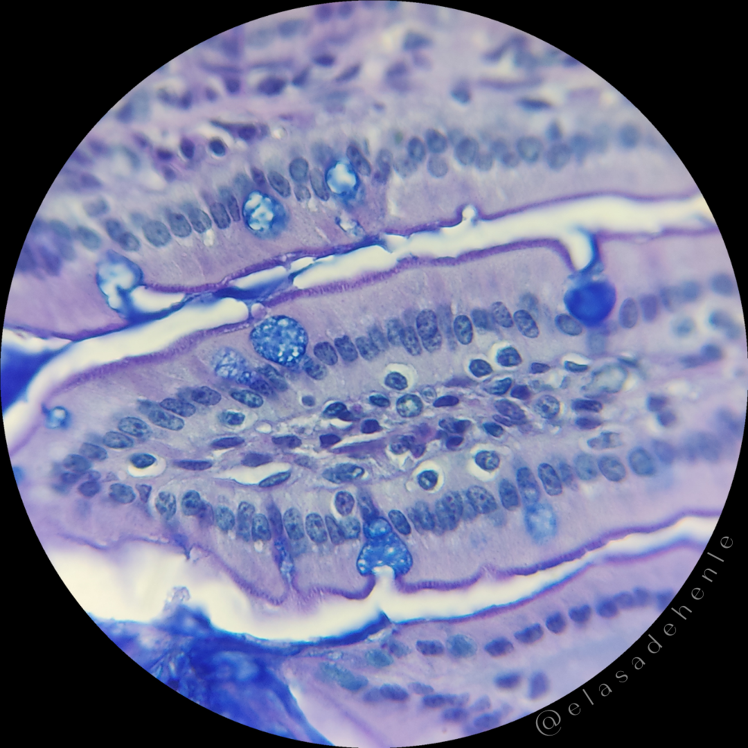 2 – El asa de Henle