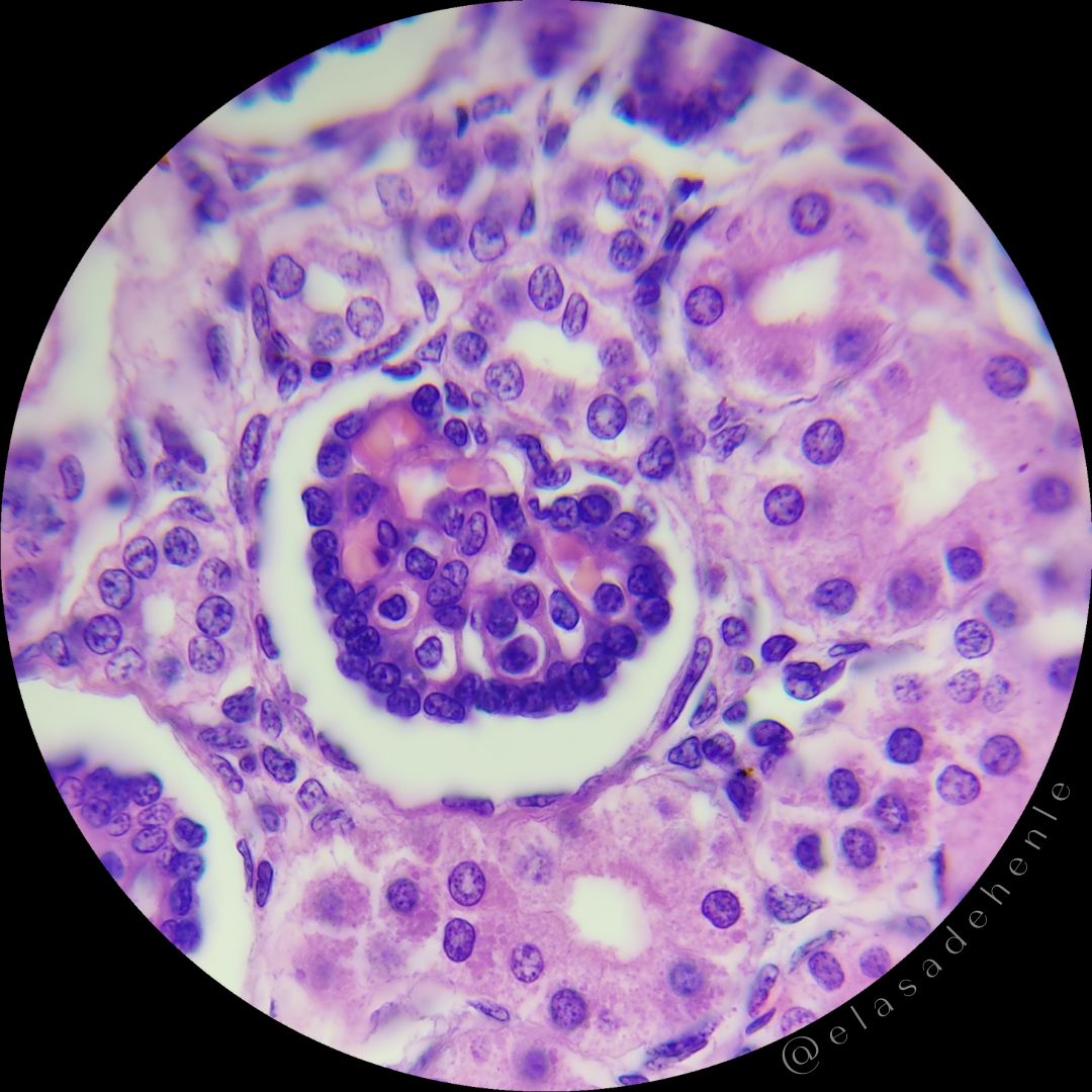 3 – El asa de Henle