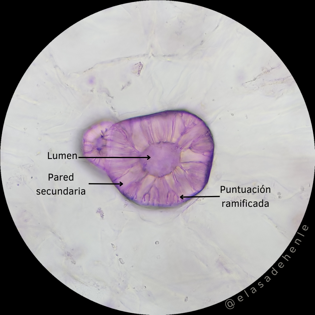 Observación de esclereidas con microscopio óptico – El asa de Henle