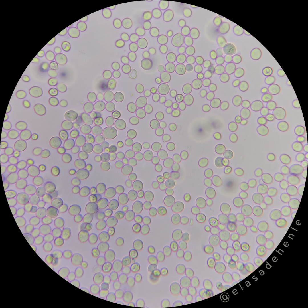 ¿Cómo podemos observar levaduras con microscopio óptico? – El asa de Henle