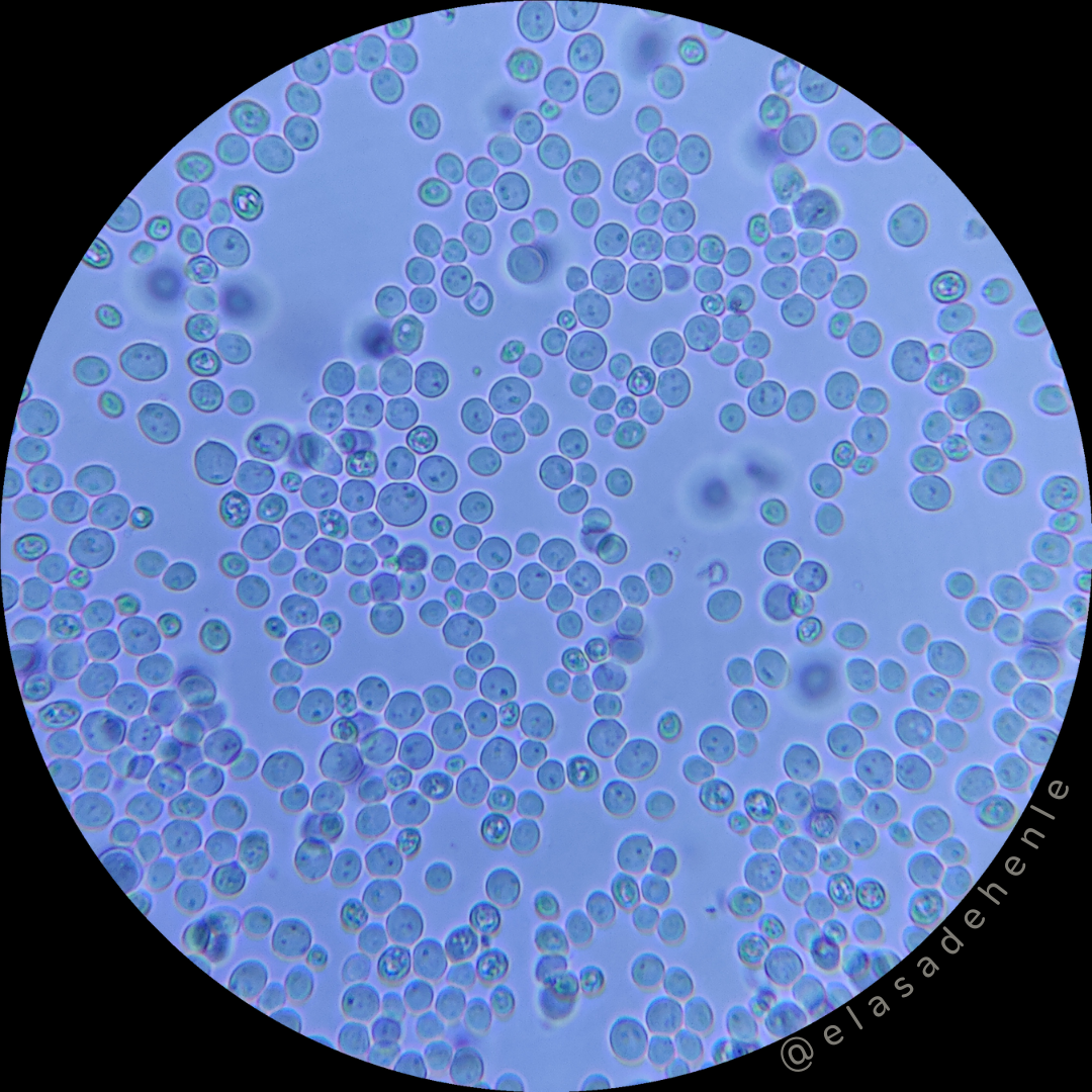 ¿Cómo podemos observar levaduras con microscopio óptico? – El asa de Henle
