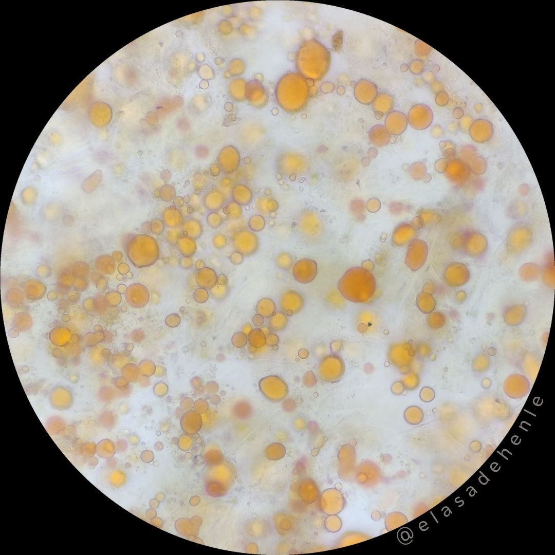 Observación de lípidos en mesocarpio de Palta – El asa de Henle