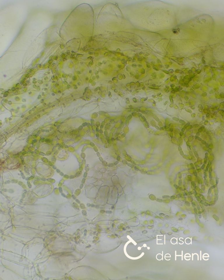 Observación de la cianobacteria Anabaena azollae – El asa de Henle